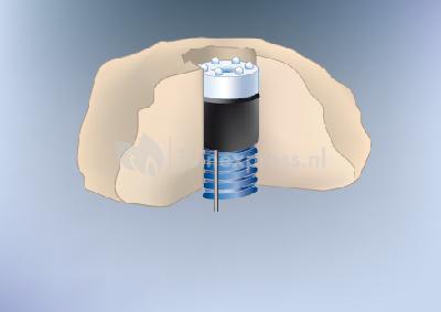 Seliger 3 LED-LIGHTS met vervangbare LED krans | Tuinexpress.nl